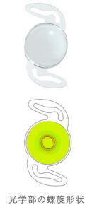 RayOne Galaxy（レイワンギャラクシー）による白内障手術｜下之城眼科クリニック