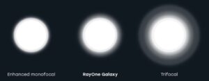 RayOne Galaxy（レイワンギャラクシー）による白内障手術｜下之城眼科クリニック